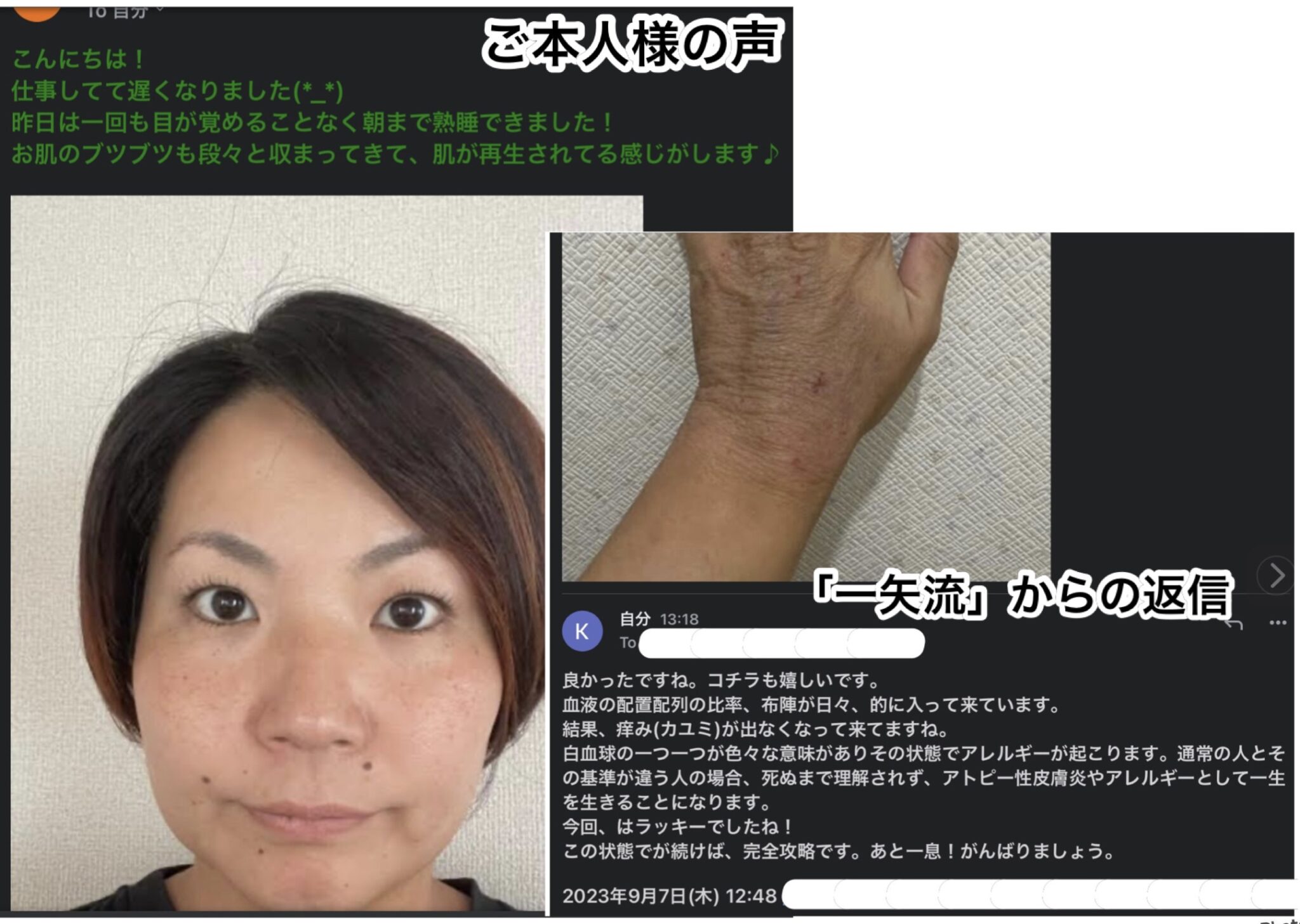 データCr21 – 「一矢(イチヤ)流」開発者本人の入力によるホームページです。自然療法•民間療法•食事療法の融合、「一矢流独自の抗酸化回復 ...